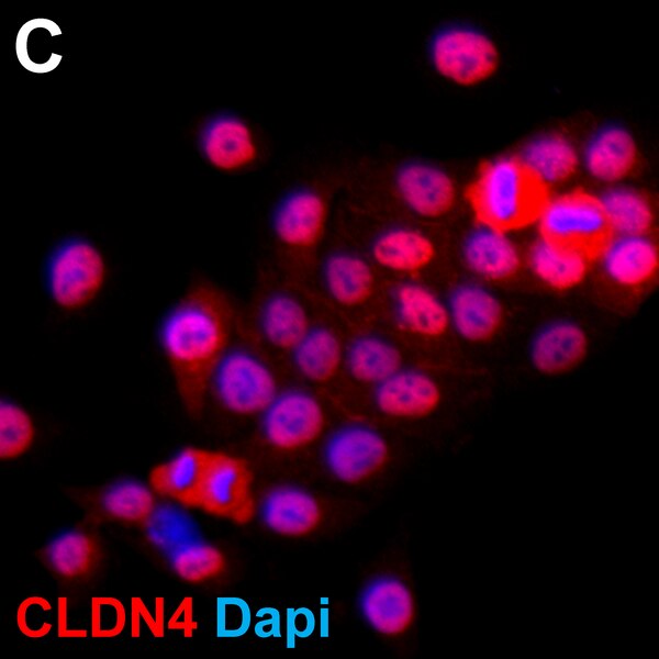 OVCAR-5 Human Cancer Cell Line | SCC259